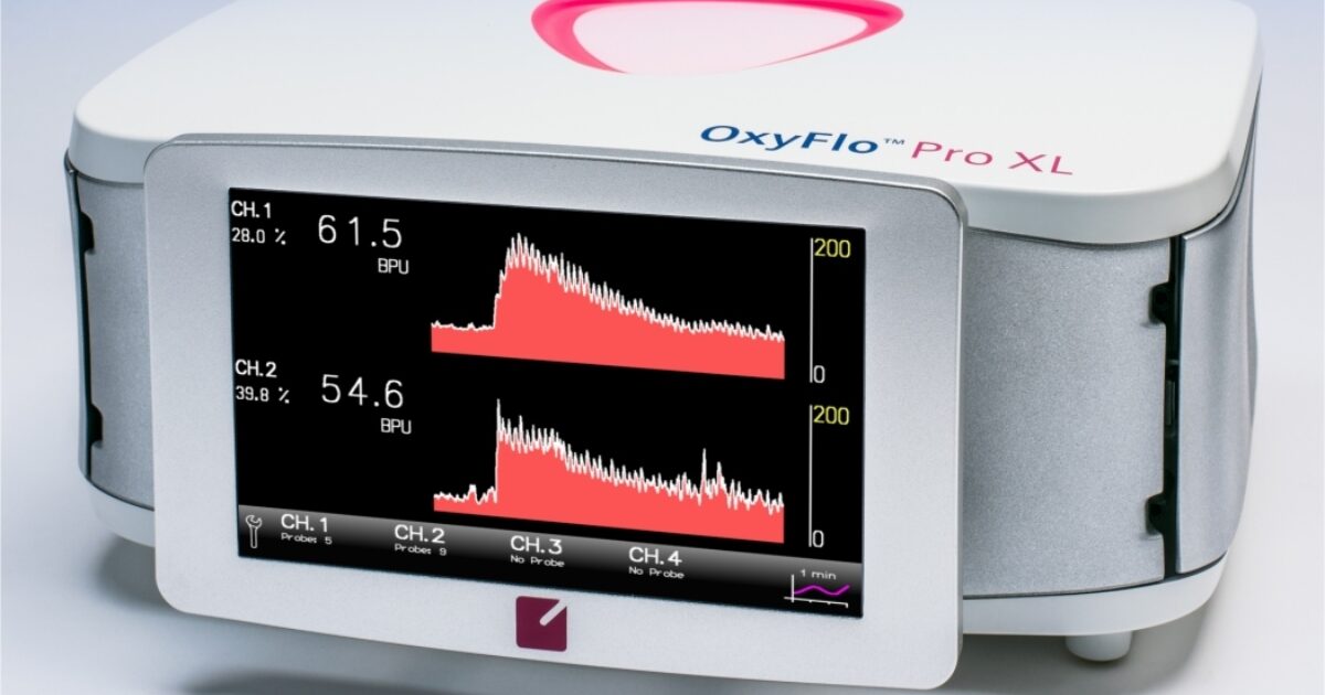 OxyFlo™ Laser Doppler Flowmetry | Oxford Optronix
